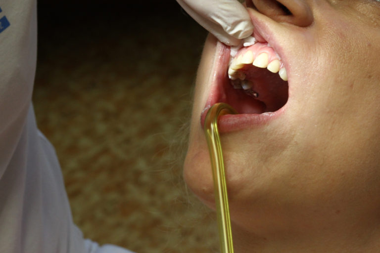 Dentum